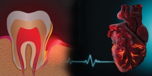Oral Health And Heart Health - What’s The Connection?