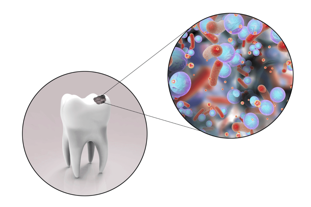 How An Infected Tooth Can Kill You: Essential Warning Signs To Know