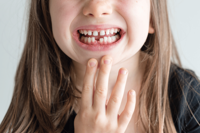 Dry Socket Vs Normal Socket After Tooth Extraction Symptoms And Healing